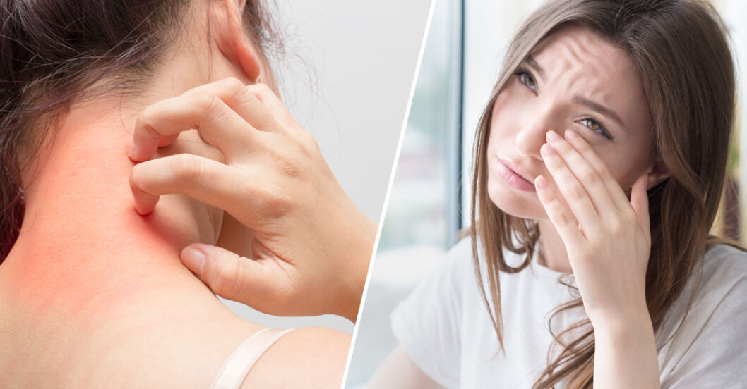 Guide: Så väljer du rätt allergimedicin | MåBra
