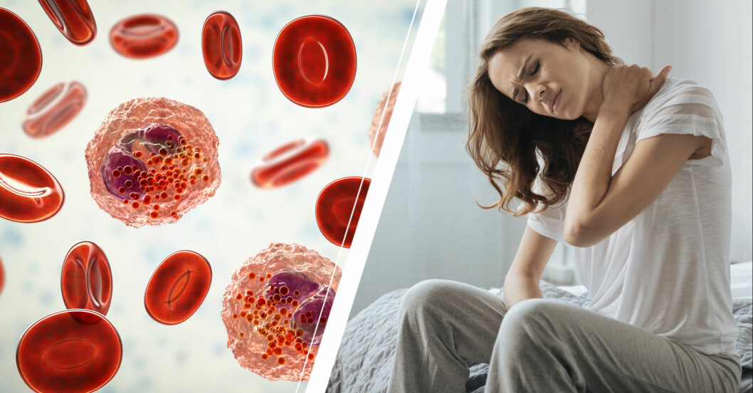 8 autoimmuna sjukdomar alla borde känna till | MåBra