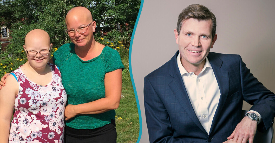 Alopecia universalis – Linda tappade håret i stora sjok | MåBra